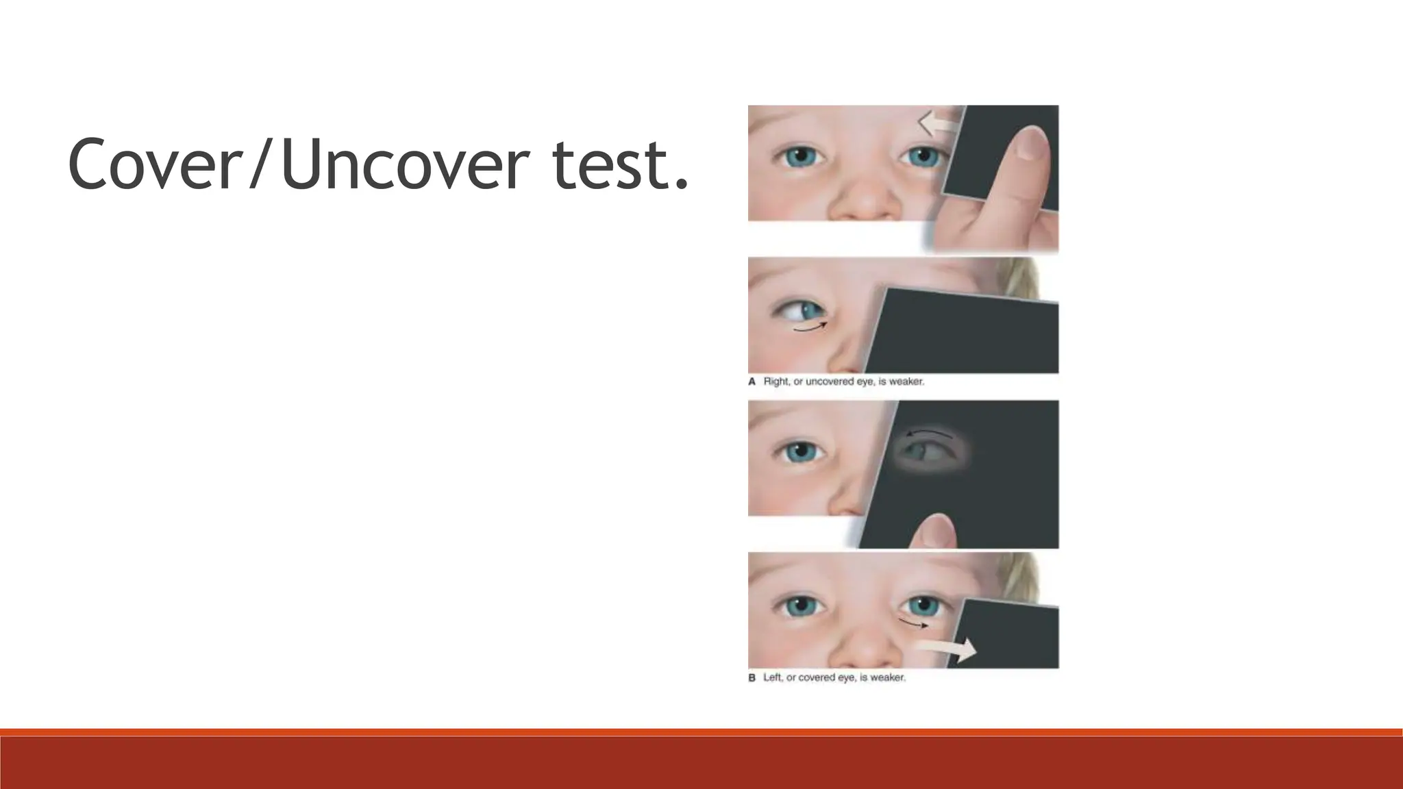 Vision assessment.pptx ophthalmology BSc nursing ppt | PPTX