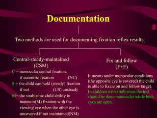 Vision assessment of the pediatric patients | PPSX