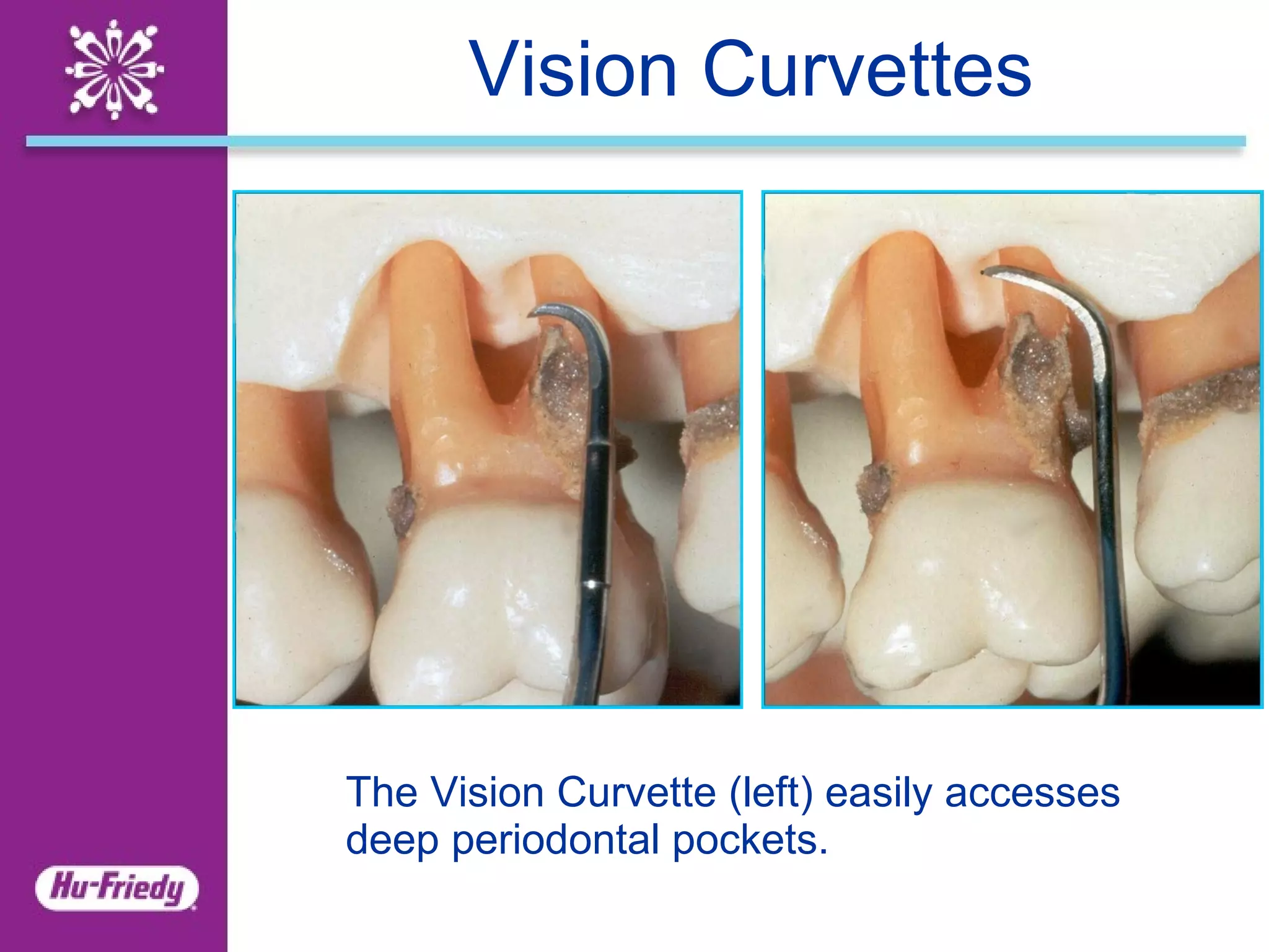 Vision Curvettes | PPT