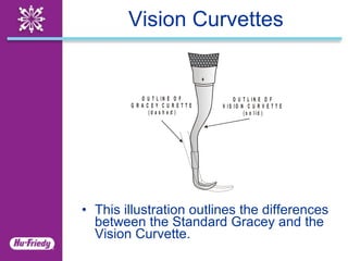 Vision Curvettes | PPT