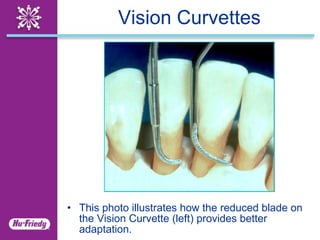 Vision Curvettes | PPT