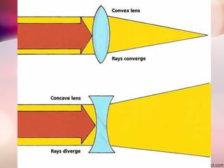 Vision defects and corrective lenses | PPT