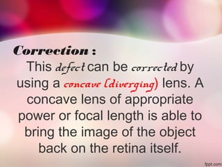 Vision defects and corrective lenses | PPT