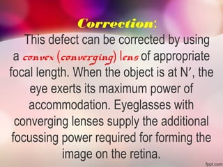 Vision defects and corrective lenses | PPT