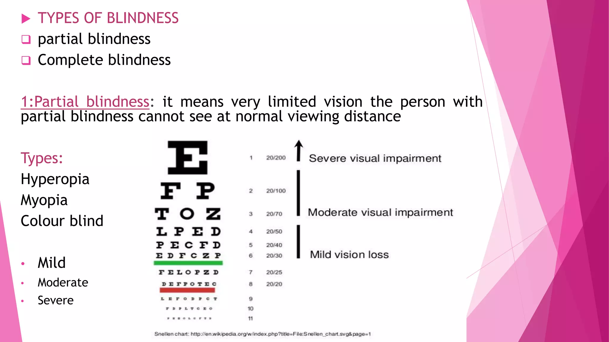 Vision disorder | PPT