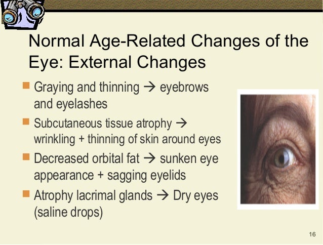 Vision in older adults spring 2014 abridged