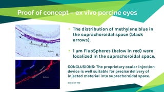 New tool for suprachoroidal drug delivery | PDF