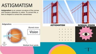 Vision Problems To learn about and teach .pptx | Free Download