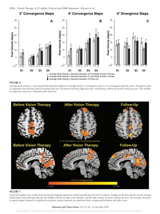 Vision therapy in_adults_with_convergence.11