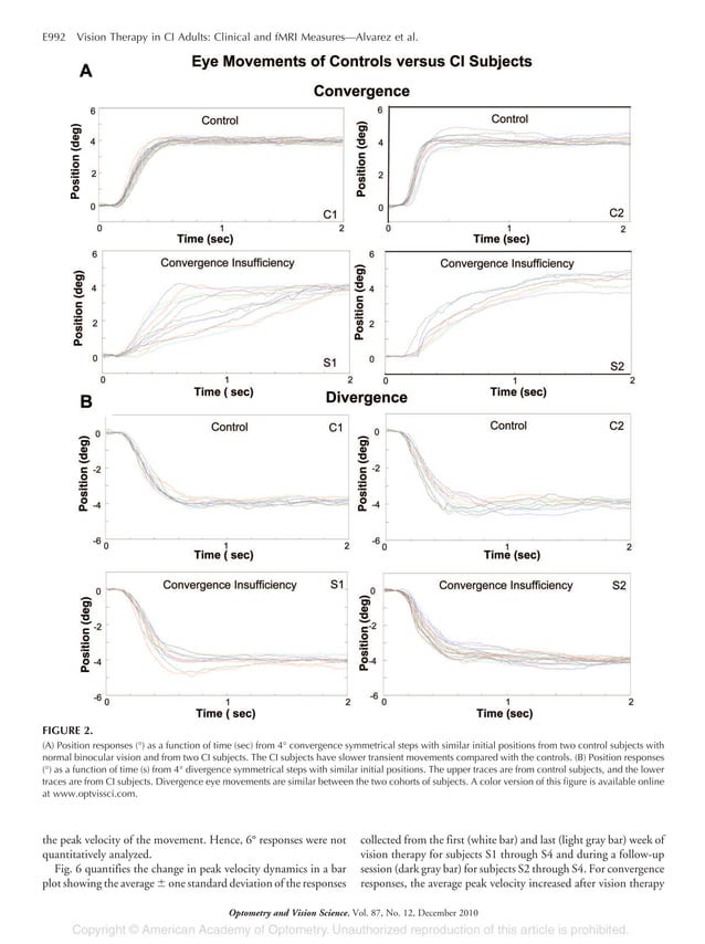 Vision therapy in_adults_with_convergence.11