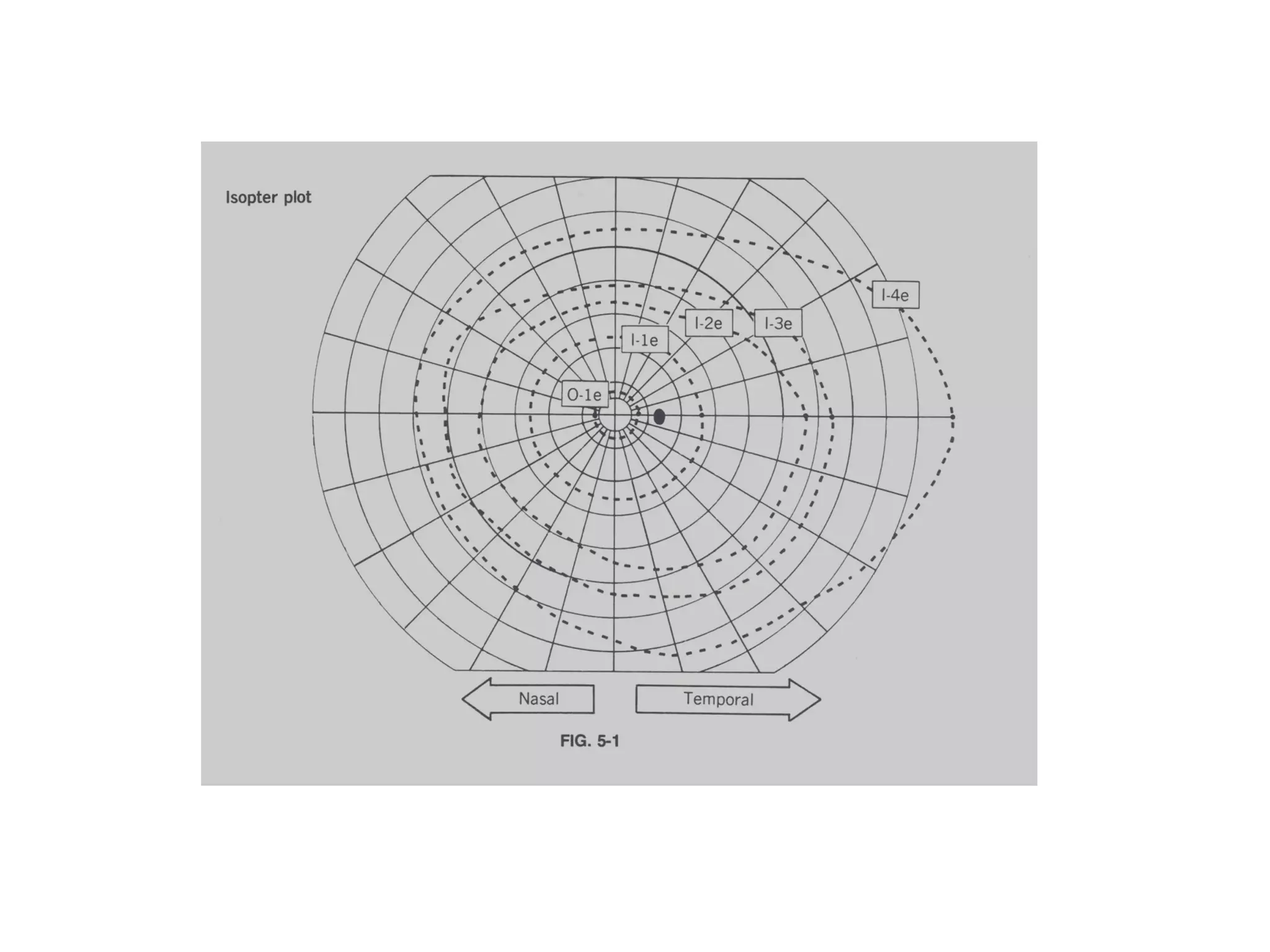 Visual field testing in pediatrics | PPT