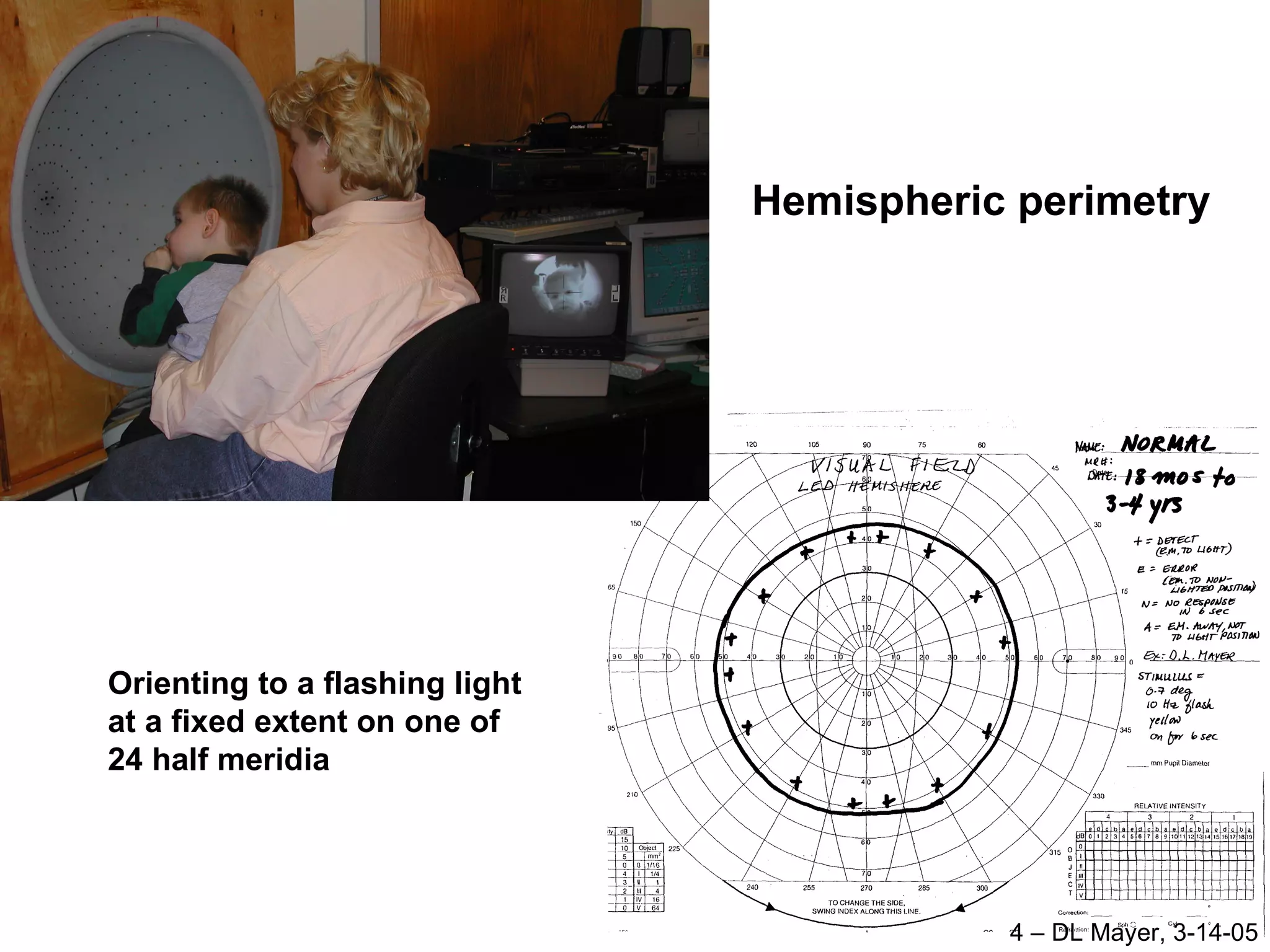 Visual field testing in pediatrics | PPT