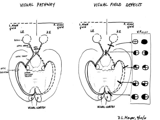 Visual field testing in pediatrics | PPT
