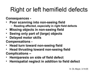 Visual field testing in pediatrics | PPT