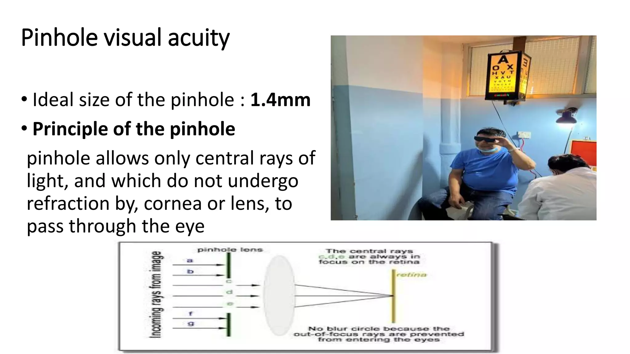 Visual Acuity.pptx