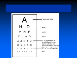 Visual acuity.ppt