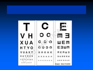Visual acuity.ppt