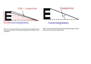 Visual Acuity.pdf