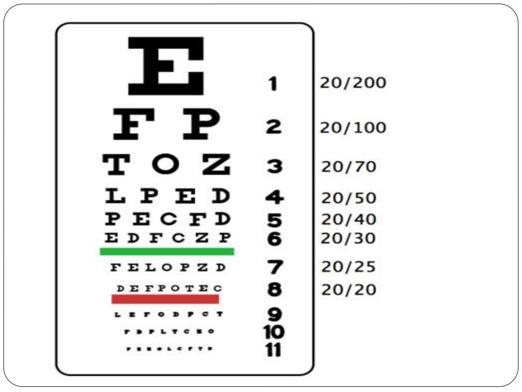 Visual Acuity 2 