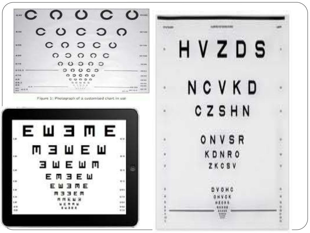 Visual acuity (2)