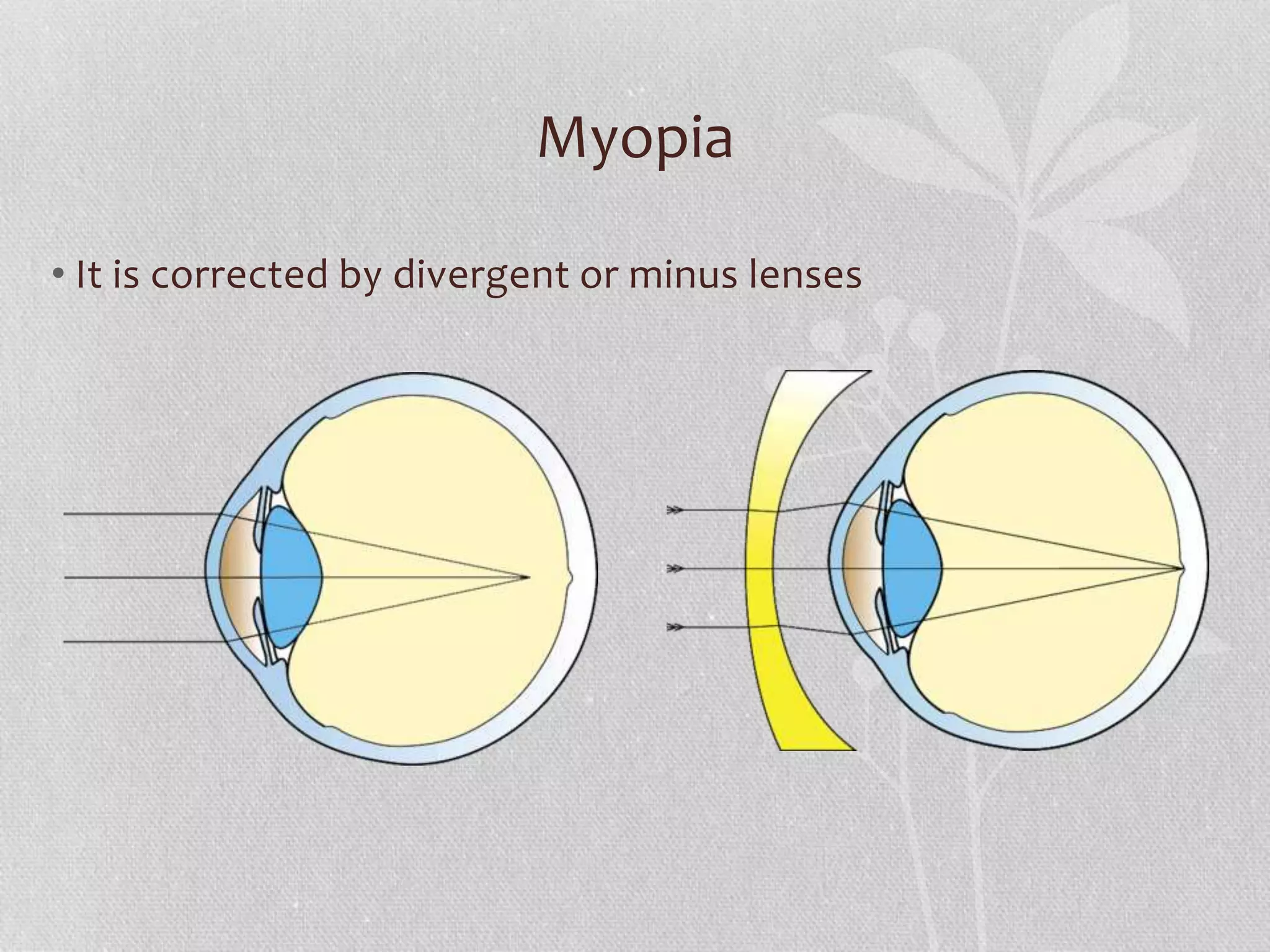 Visual acuity and its disturbances (asik) | PPT