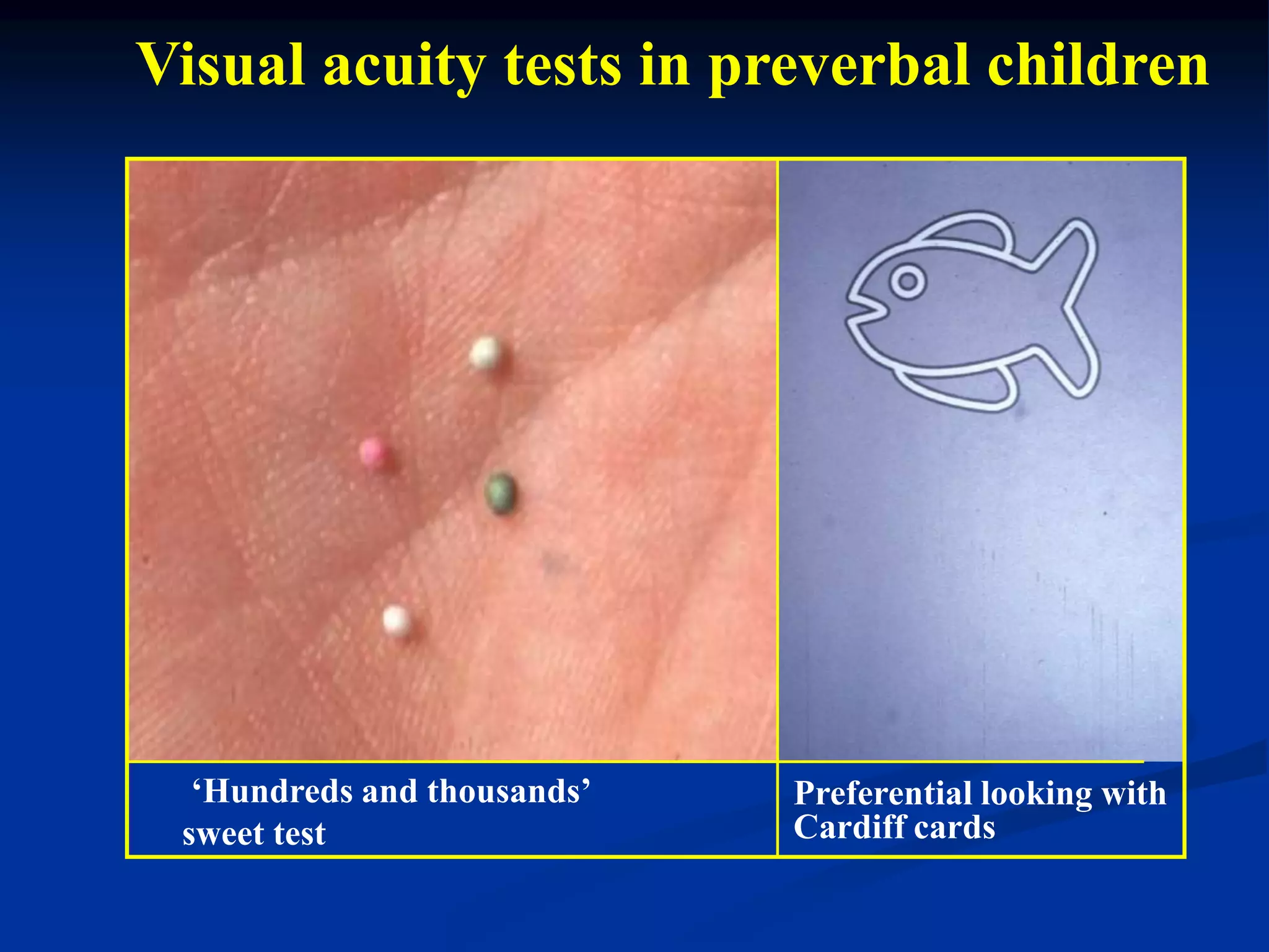 Visual acuity assessment in different group of age | PPTX