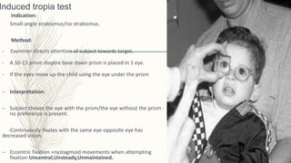 Visual acuity assessment in paediatric patients.pptx2222 | PPTX