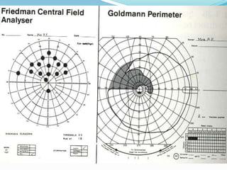 Visual acuity & colour vision | PPTX