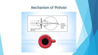 Visual acuity examination(adult) Update (1).pptx