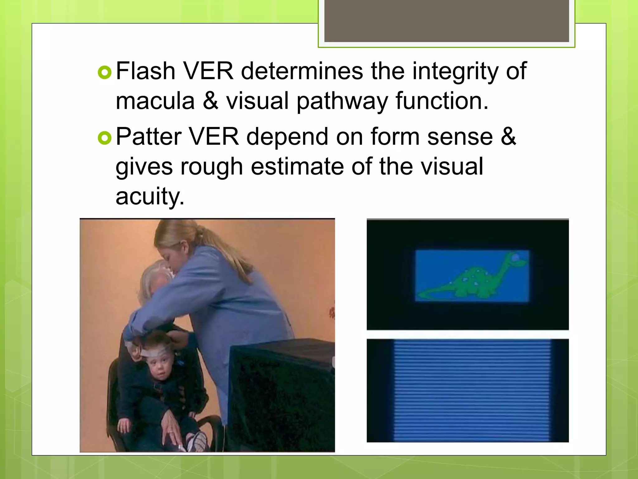 Visual acuity in infants | PPTX