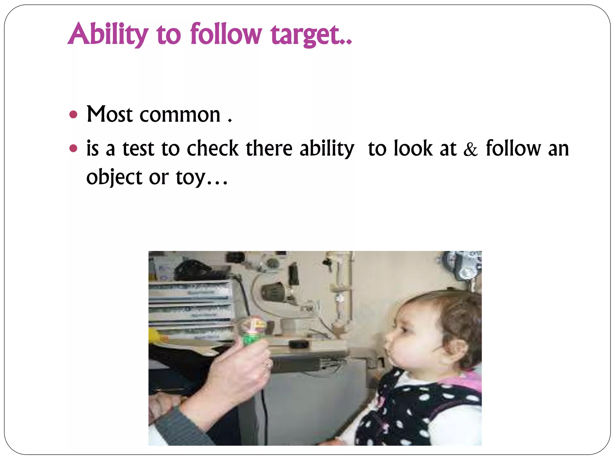 Visual acuity in infants | PPTX