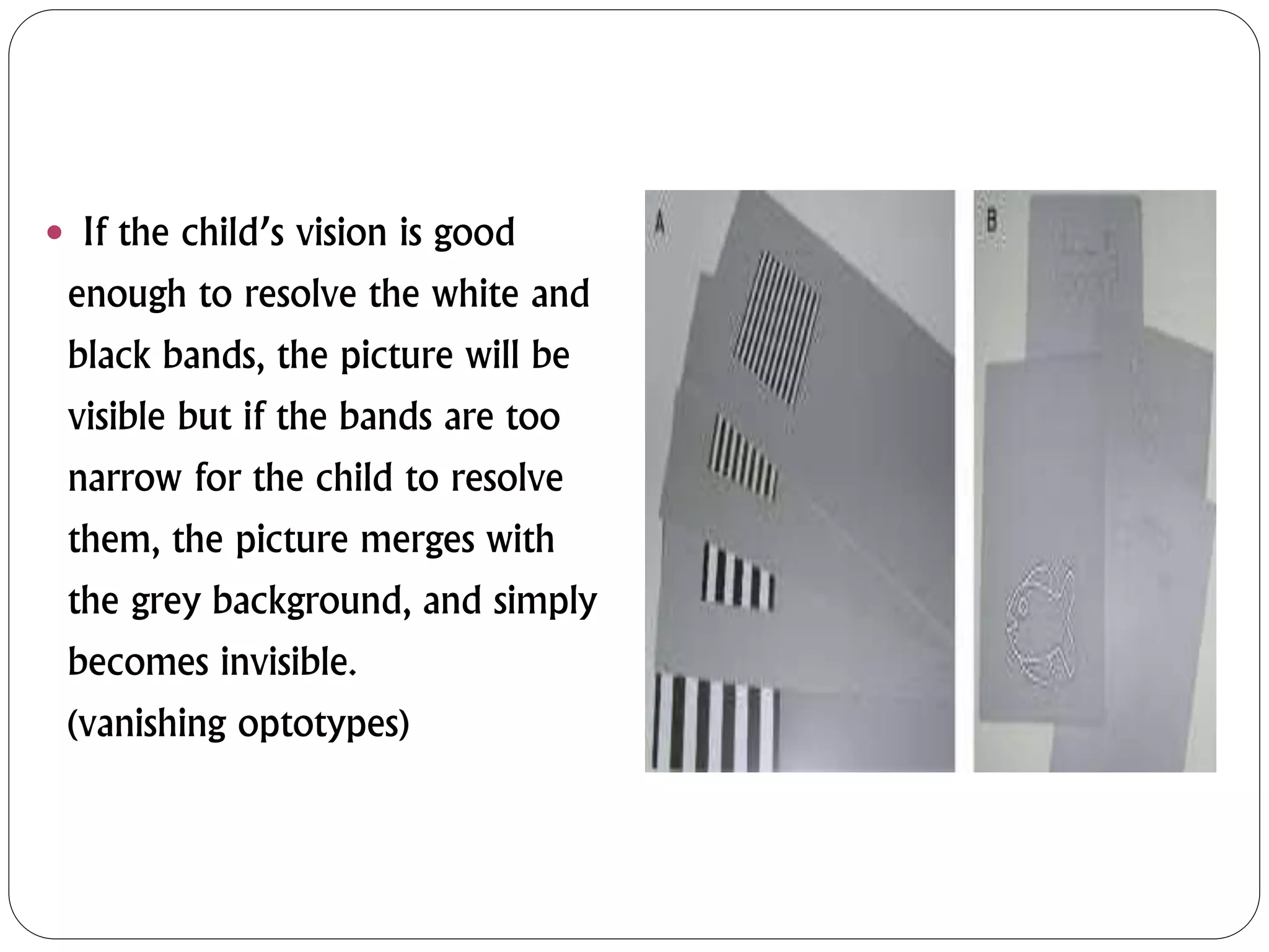Visual acuity in infants | PPTX