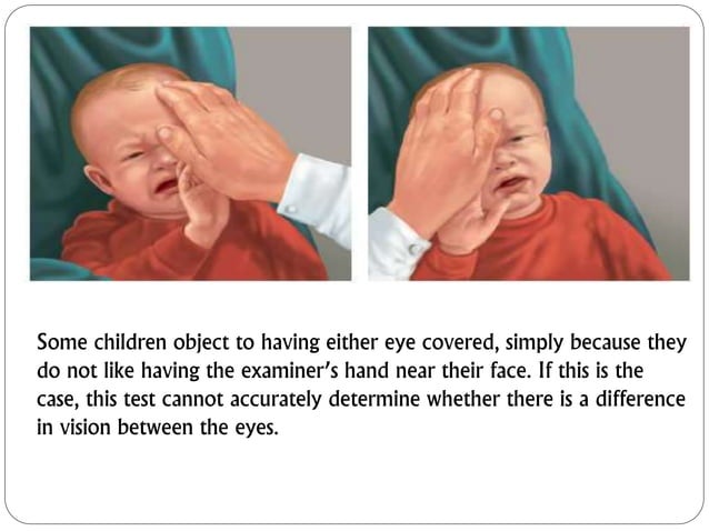 Visual acuity in infants | PPTX