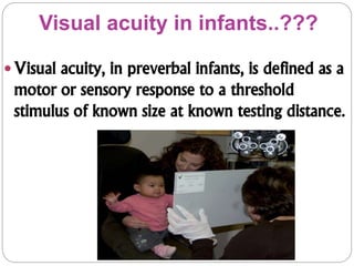 Visual acuity in infants | PPTX