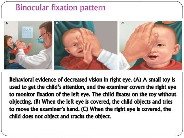 Visual acuity in infants