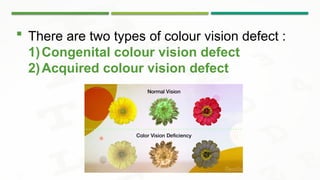 visual acuity : Near, pinhole and color vision | PPTX | Eye and Vision ...