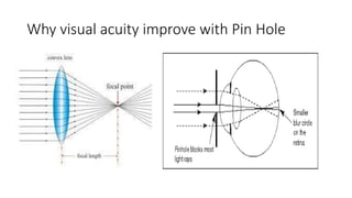 Visual Acuity and Its Importance in life | PPTX | Eye and Vision ...