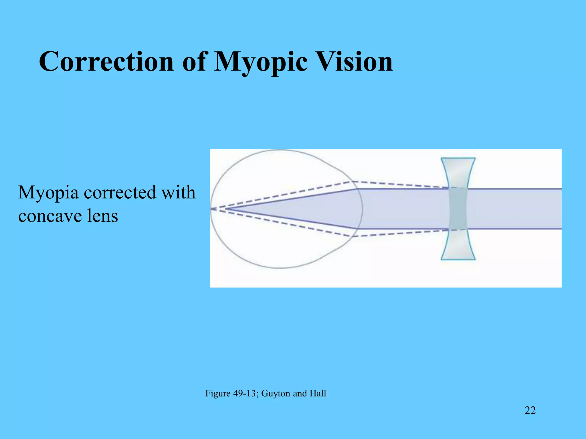 Visual Acuity & Refractive Errors.ppt