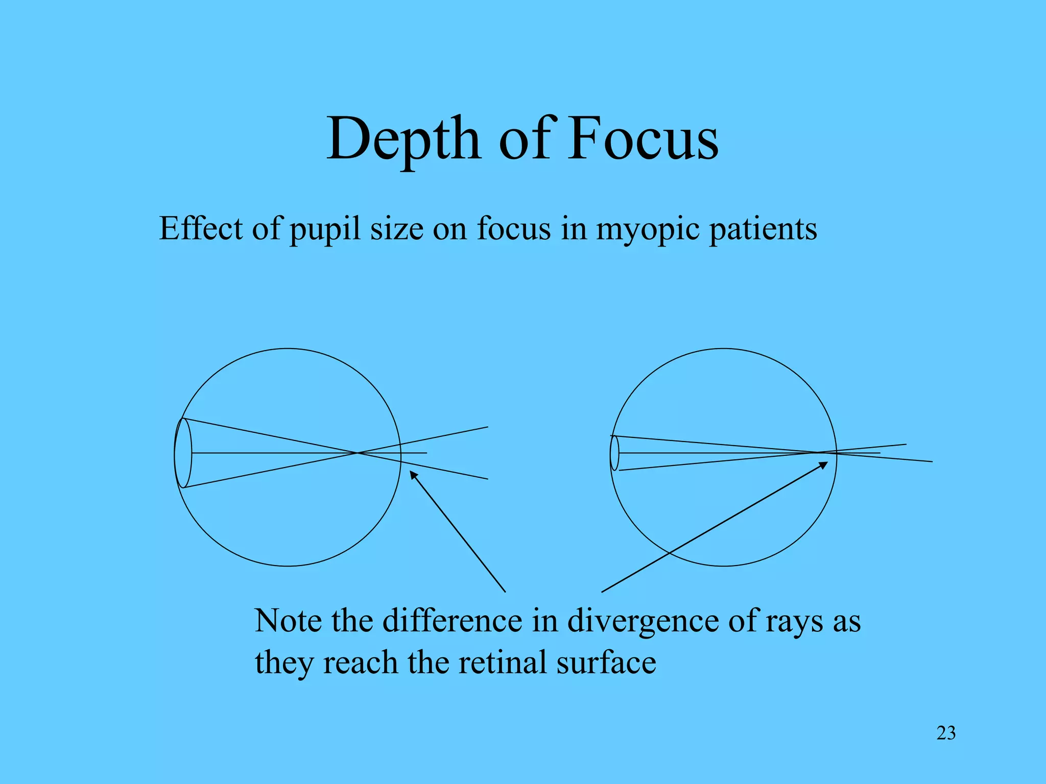 Visual Acuity & Refractive Errors.ppt