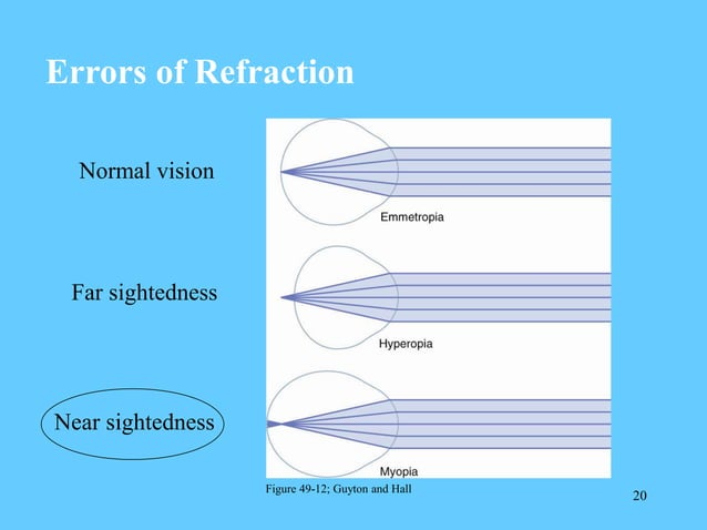 Visual Acuity & Refractive Errors.ppt