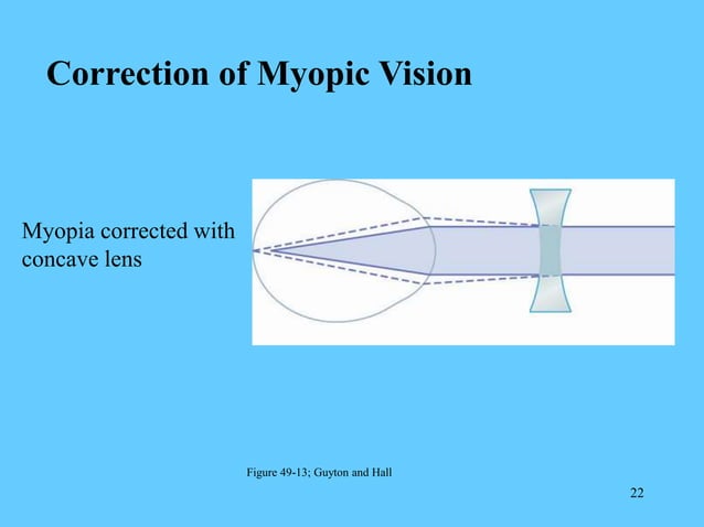 Visual Acuity & Refractive Errors.ppt