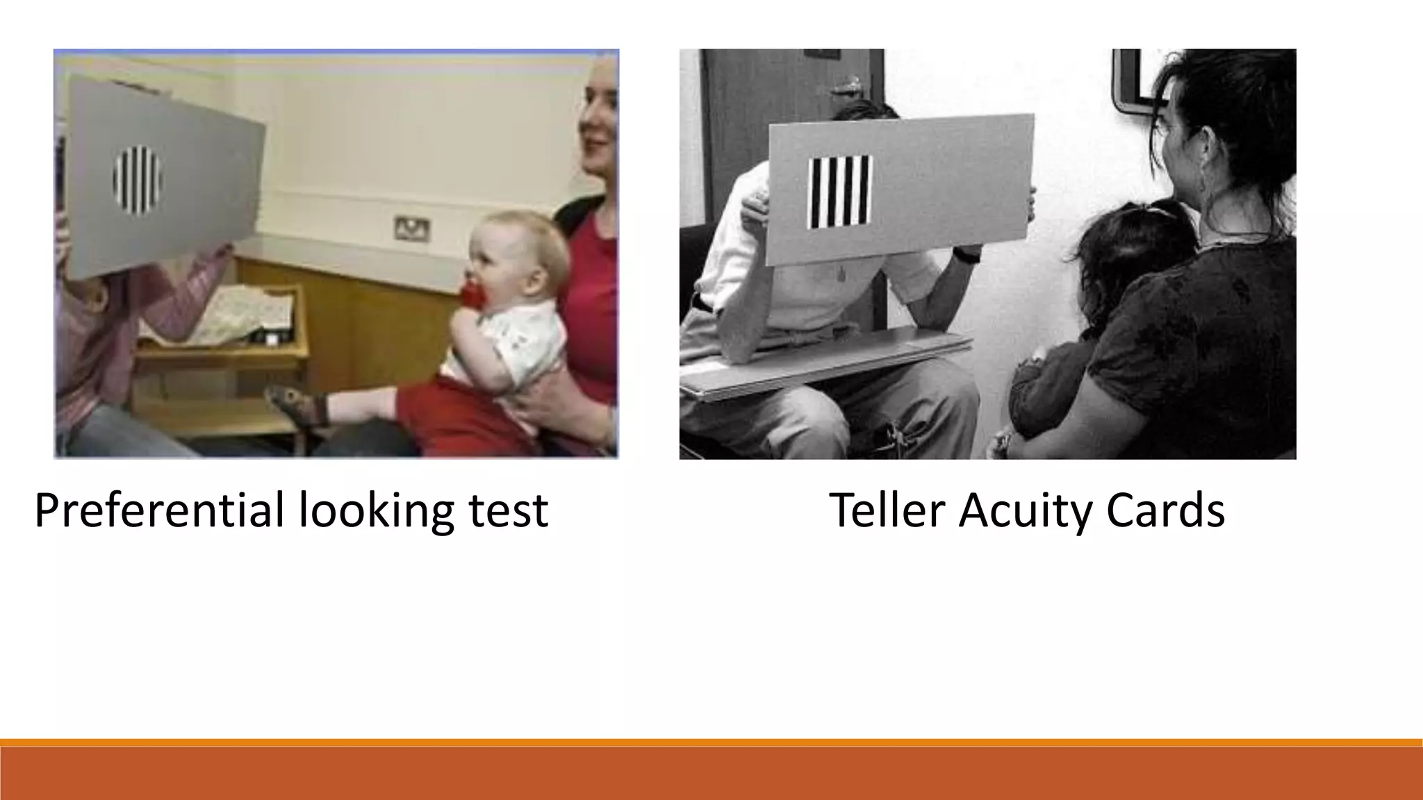 Visual acuity testing | PPTX | Eye and Vision Conditions | Diseases and ...