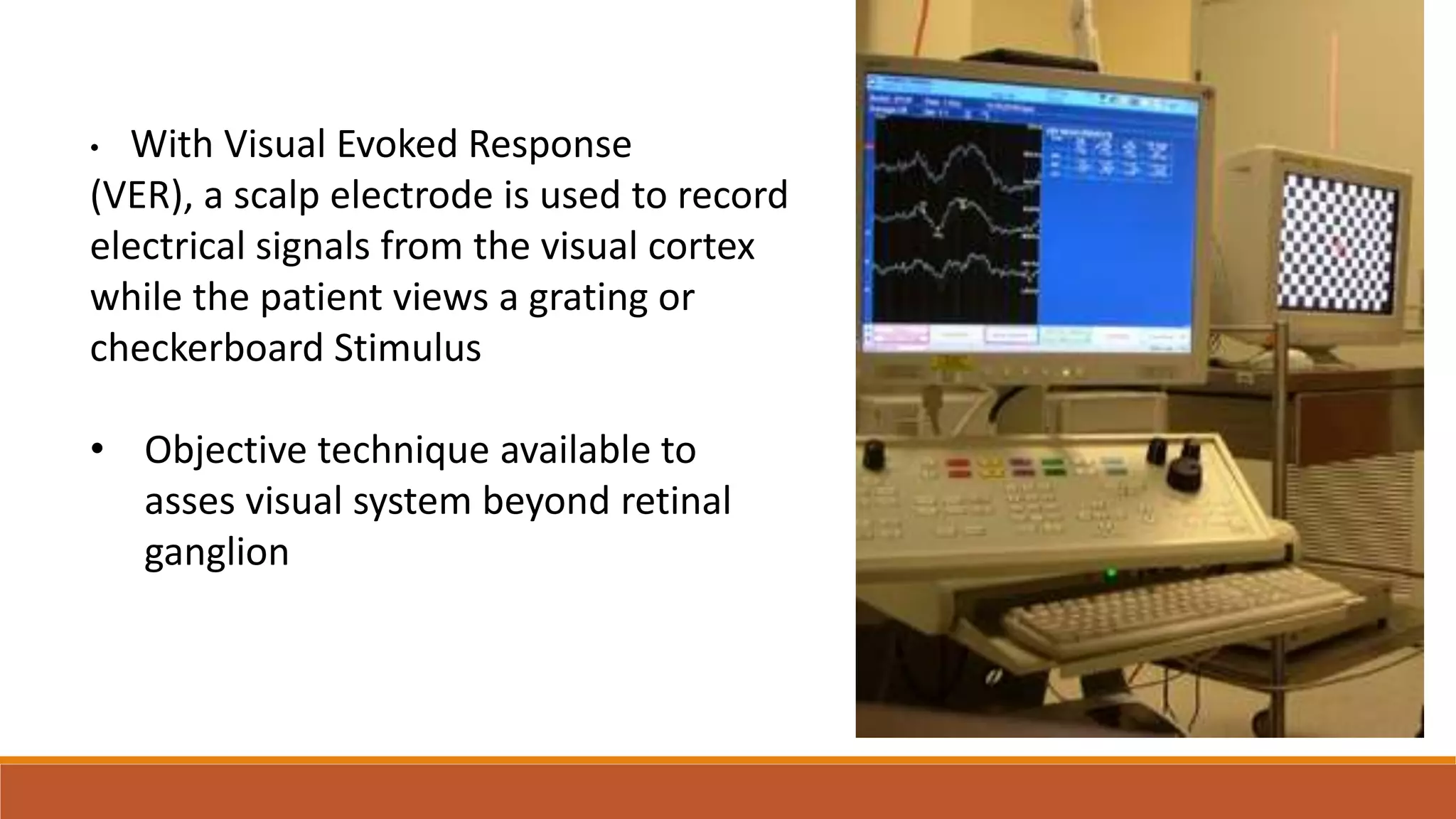 Visual acuity testing | PPTX