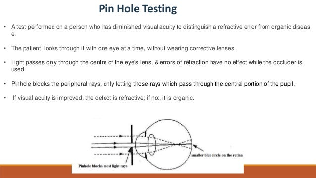 visual-acuity-testing