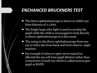 Visual acuity test in infants | PPTX