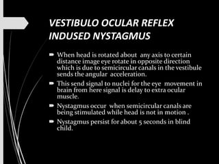 Visual acuity test in infants | PPTX