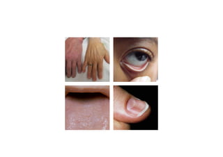 Visual Add for Home Remedies | PDF