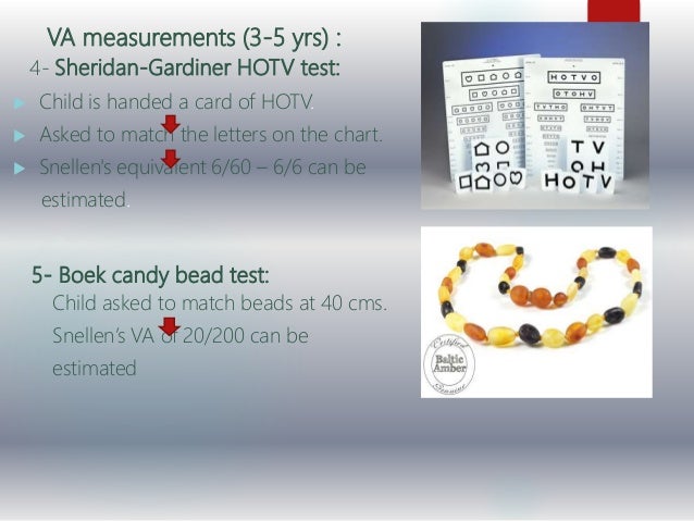 Visual aquity and contrast sensitivity