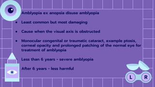 Visual axis deprivation amblyopia.pdf