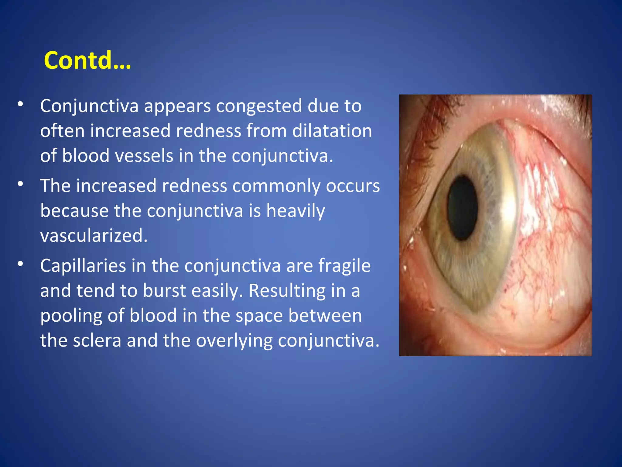 Visual changes in aging | PPT